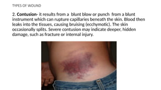 SKIN INTEGRITY AND WOUND CAREd RNAC2pptx | PPTX