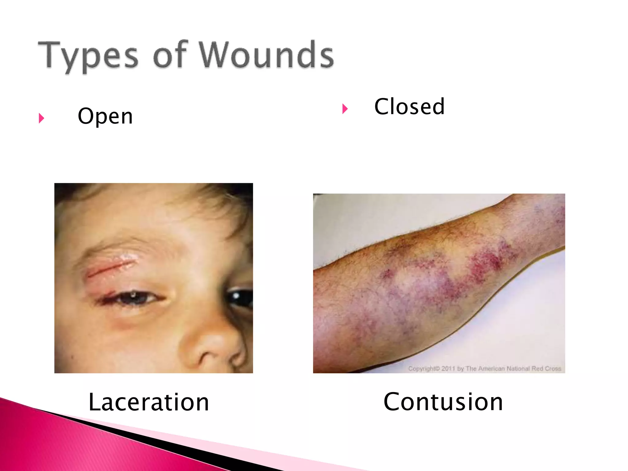 Skin Integrity and Wound Healingstudentvers.pptx