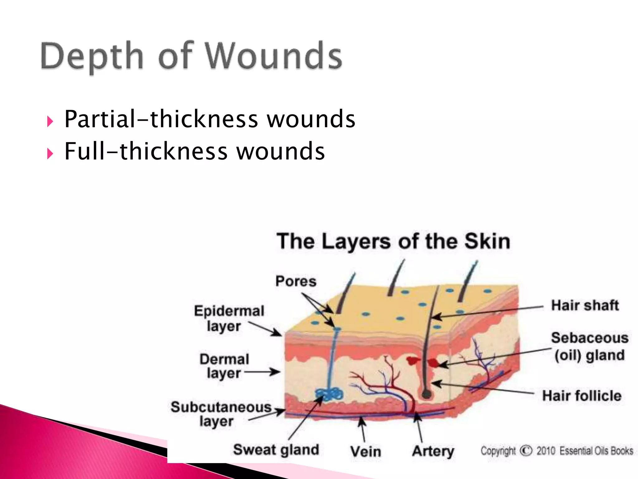 Skin Integrity and Wound Healingstudentvers.pptx