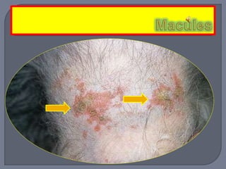 Canine Skin lesion | PPTX