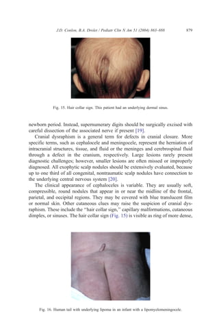 Skin lesion in neonate | PDF