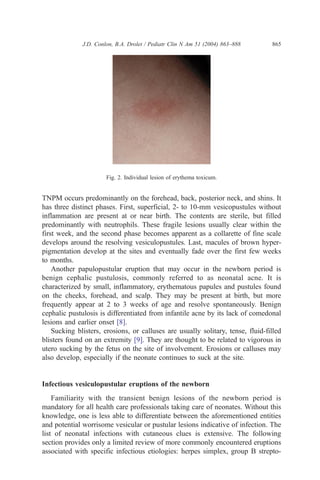 Skin lesion in neonate | PDF