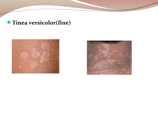 Skin lesions.pdf