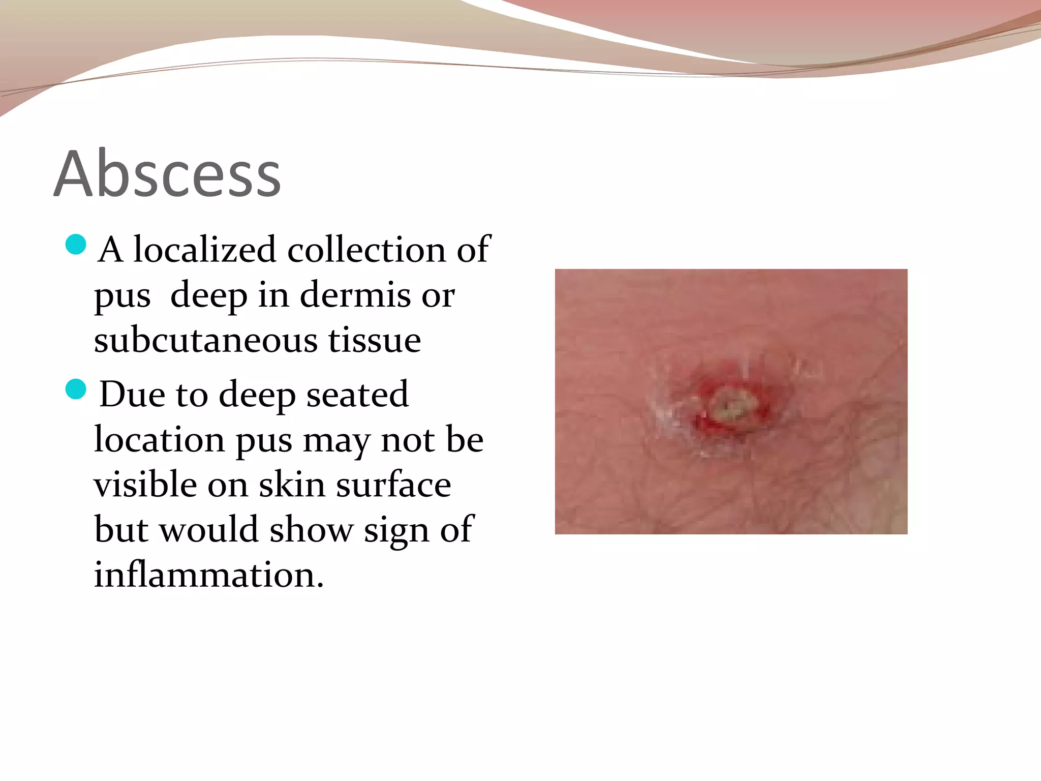 Skin lesions | PPT
