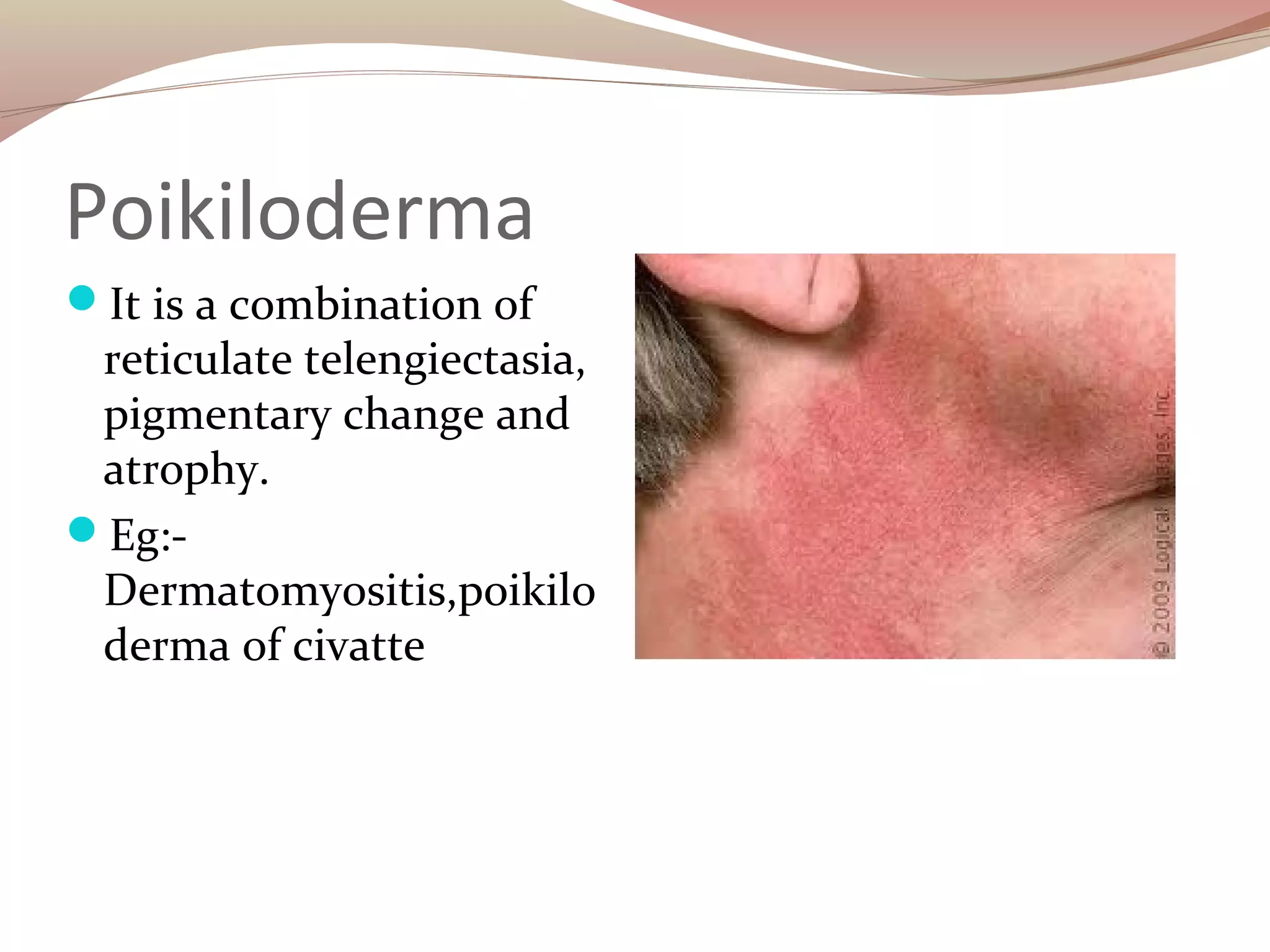 Skin lesions | PPT