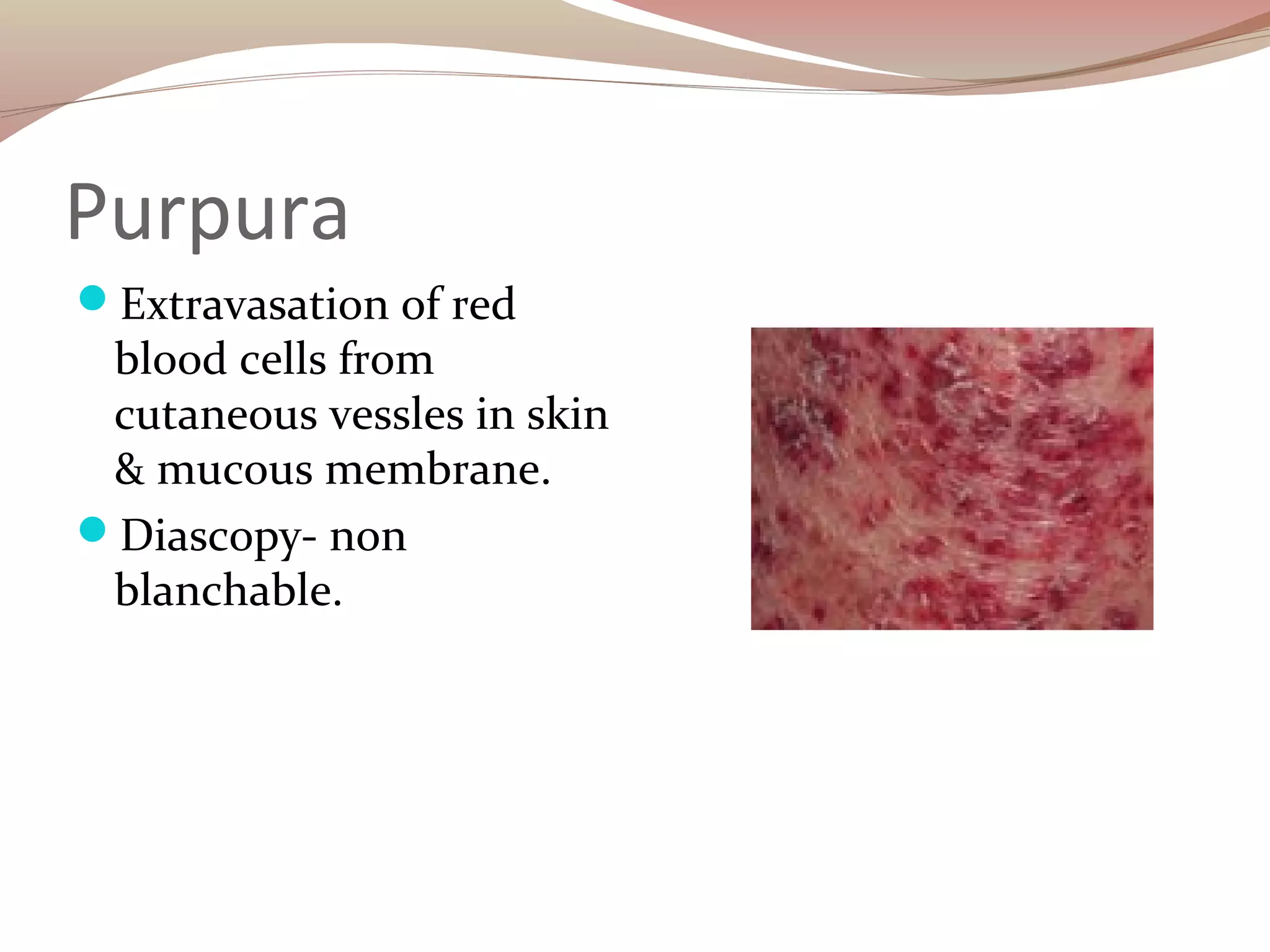 Skin lesions | PPT