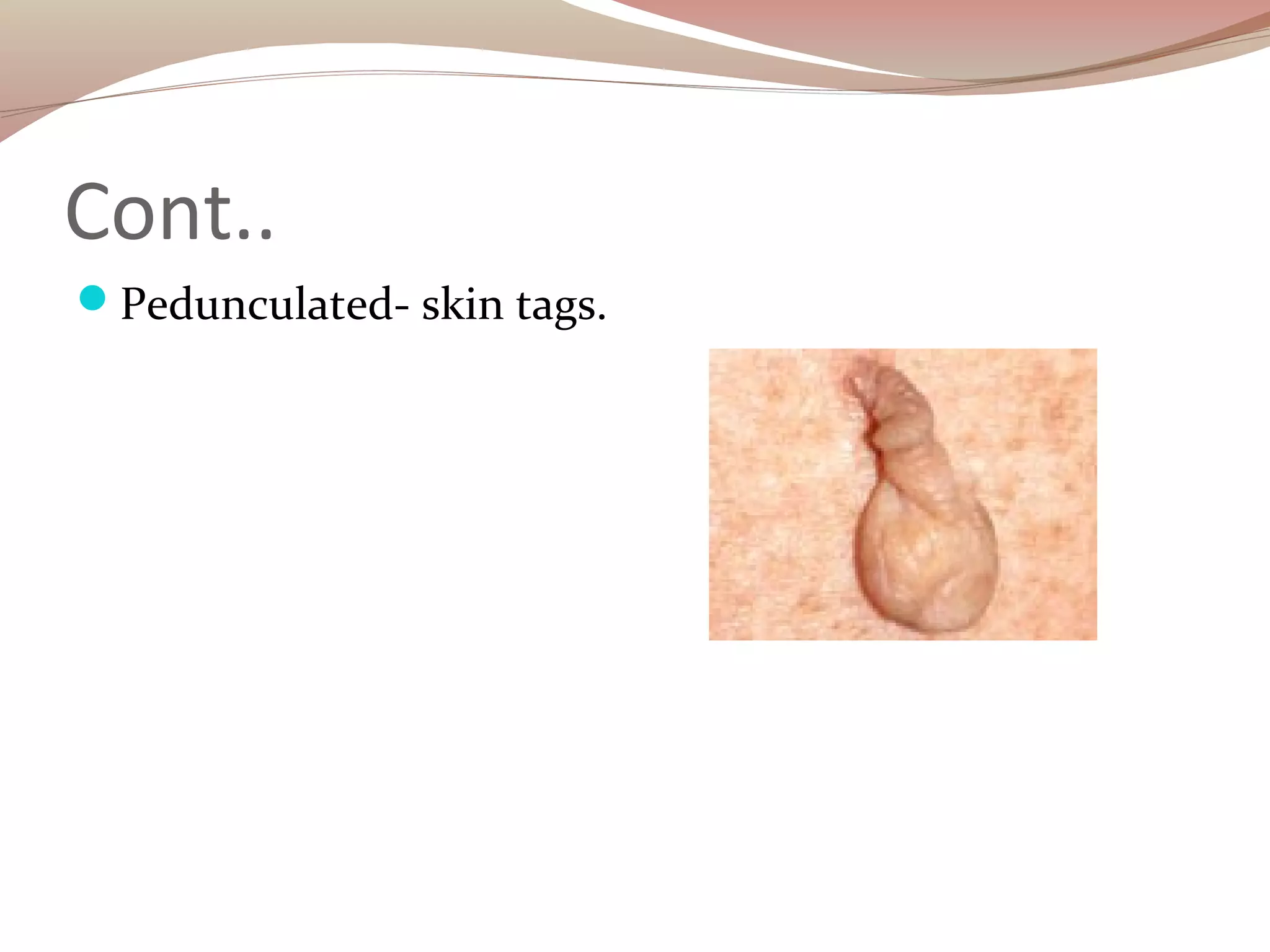 Skin lesions | PPT