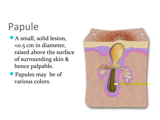 Skin lesions | PPT