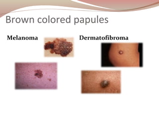 Skin lesions | PPT