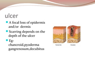 Skin lesions | PPT