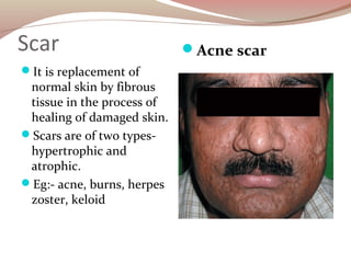 Skin lesions | PPT