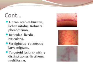 Skin lesions | PPT