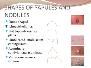 Nodule Vs Papule