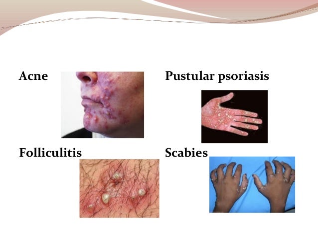Skin lesions