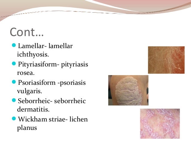 Skin lesions
