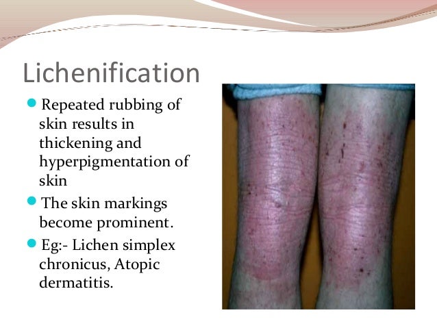 Skin lesions