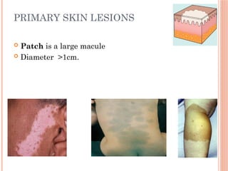 Skin lesions 2.PowerPoint for healthy .. | PPTX