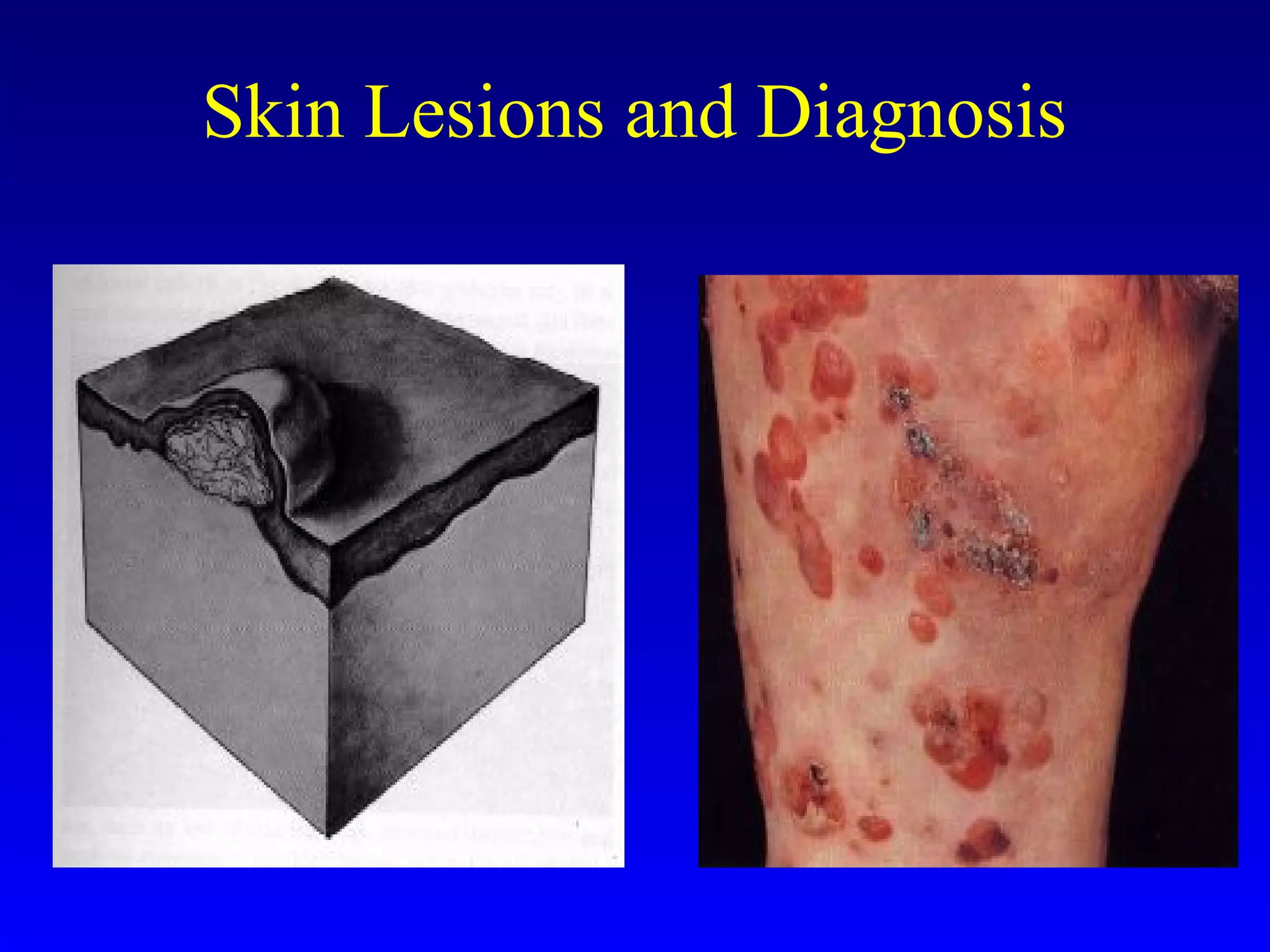 Skin lesions and diagnosis | PPT
