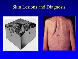 Skin lesions and diagnosis | PPT