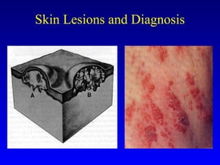 Skin lesions and diagnosis | PPT | Skin and Dermatology | Diseases and ...