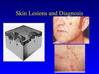 Skin lesions and diagnosis | PPT