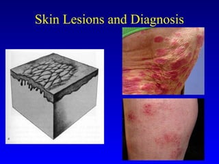 Skin lesions and diagnosis | PPT