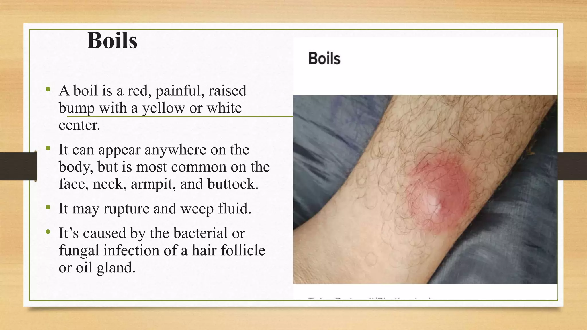 SKIN LESIONS ibn sina.pptx