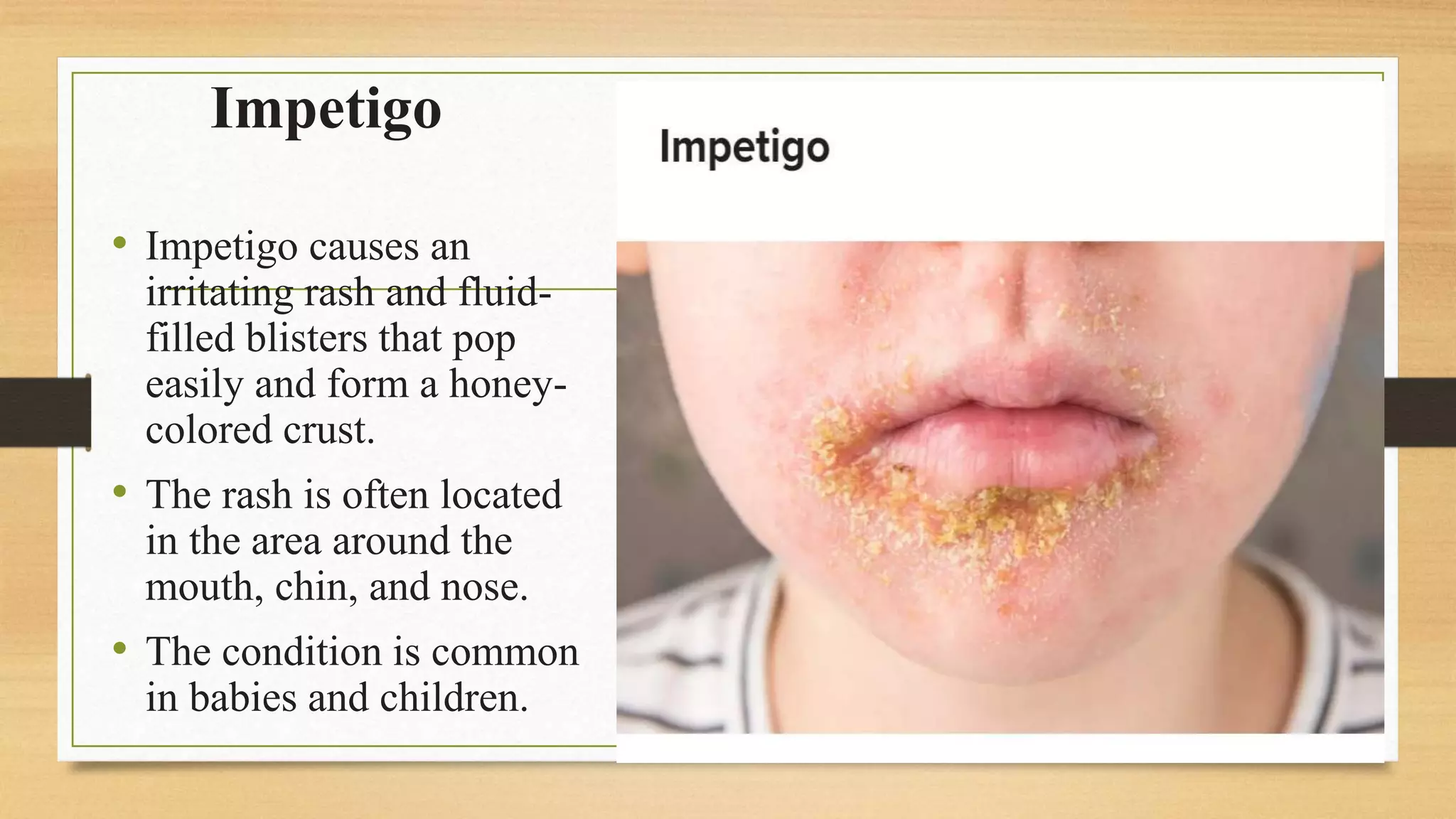 SKIN LESIONS ibn sina.pptx
