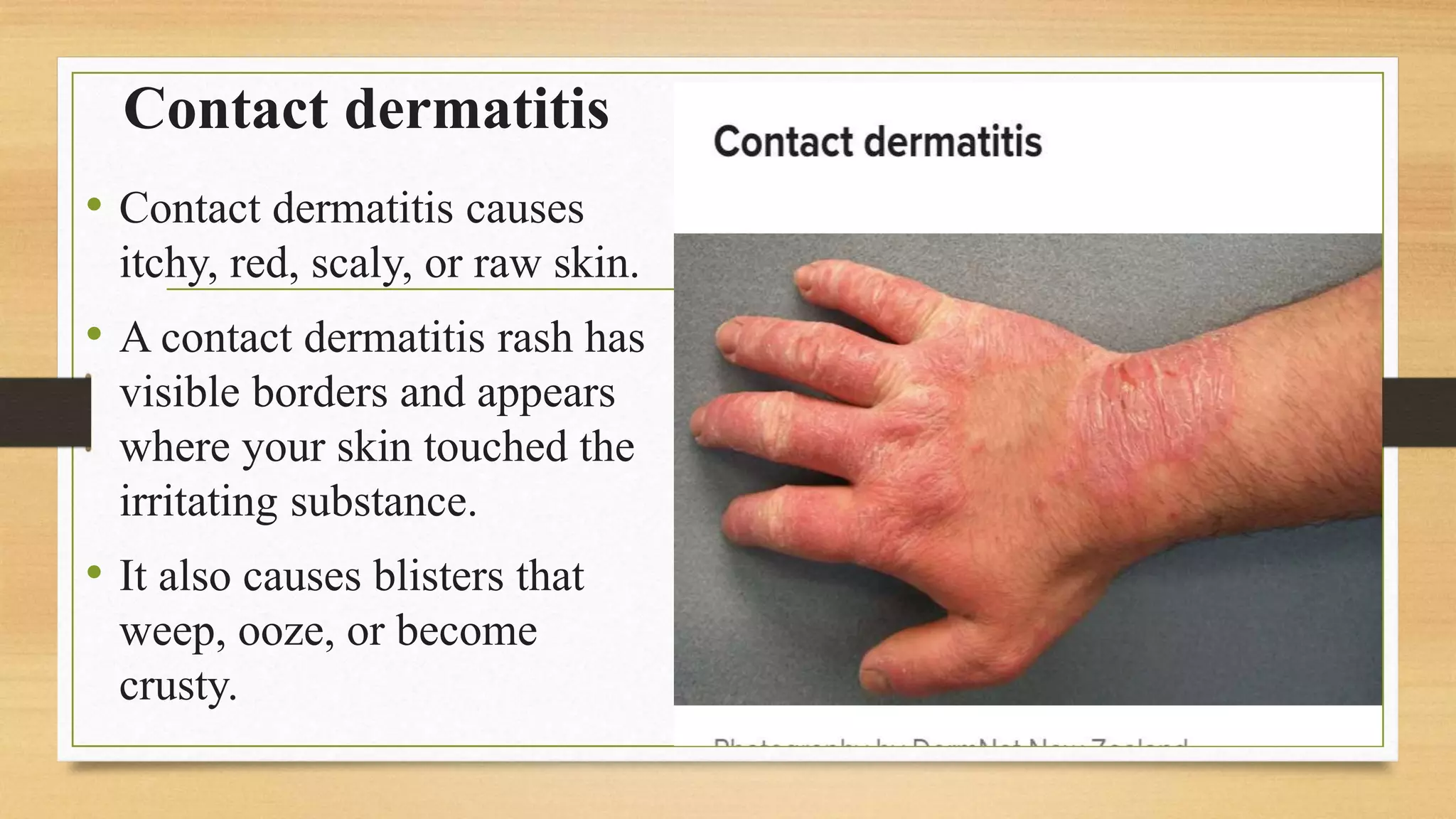 SKIN LESIONS ibn sina.pptx