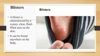 SKIN LESIONS ibn sina.pptx