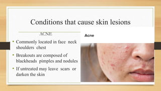 SKIN LESIONS ibn sina.pptx