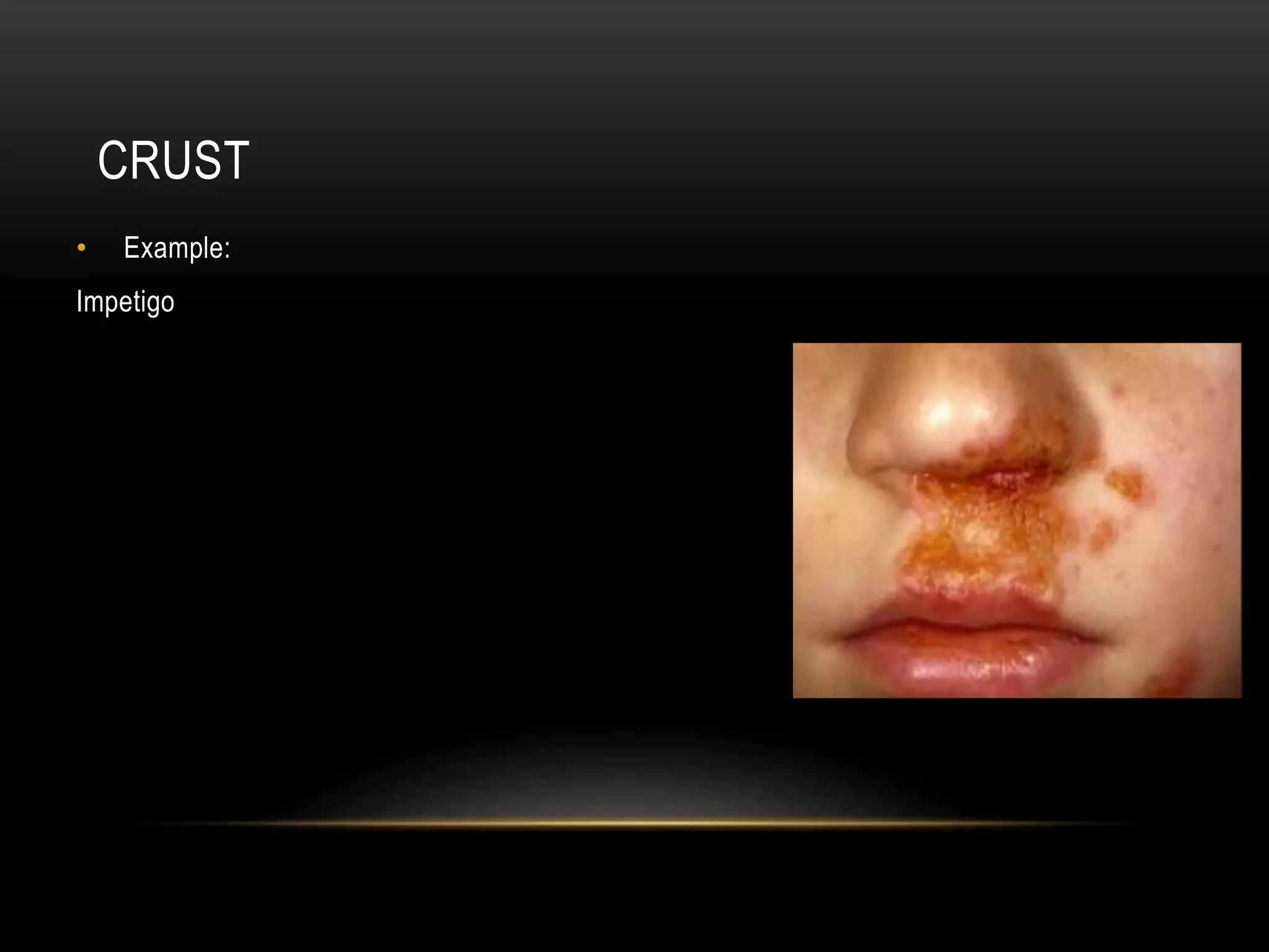Skin lesions morphology.pptx