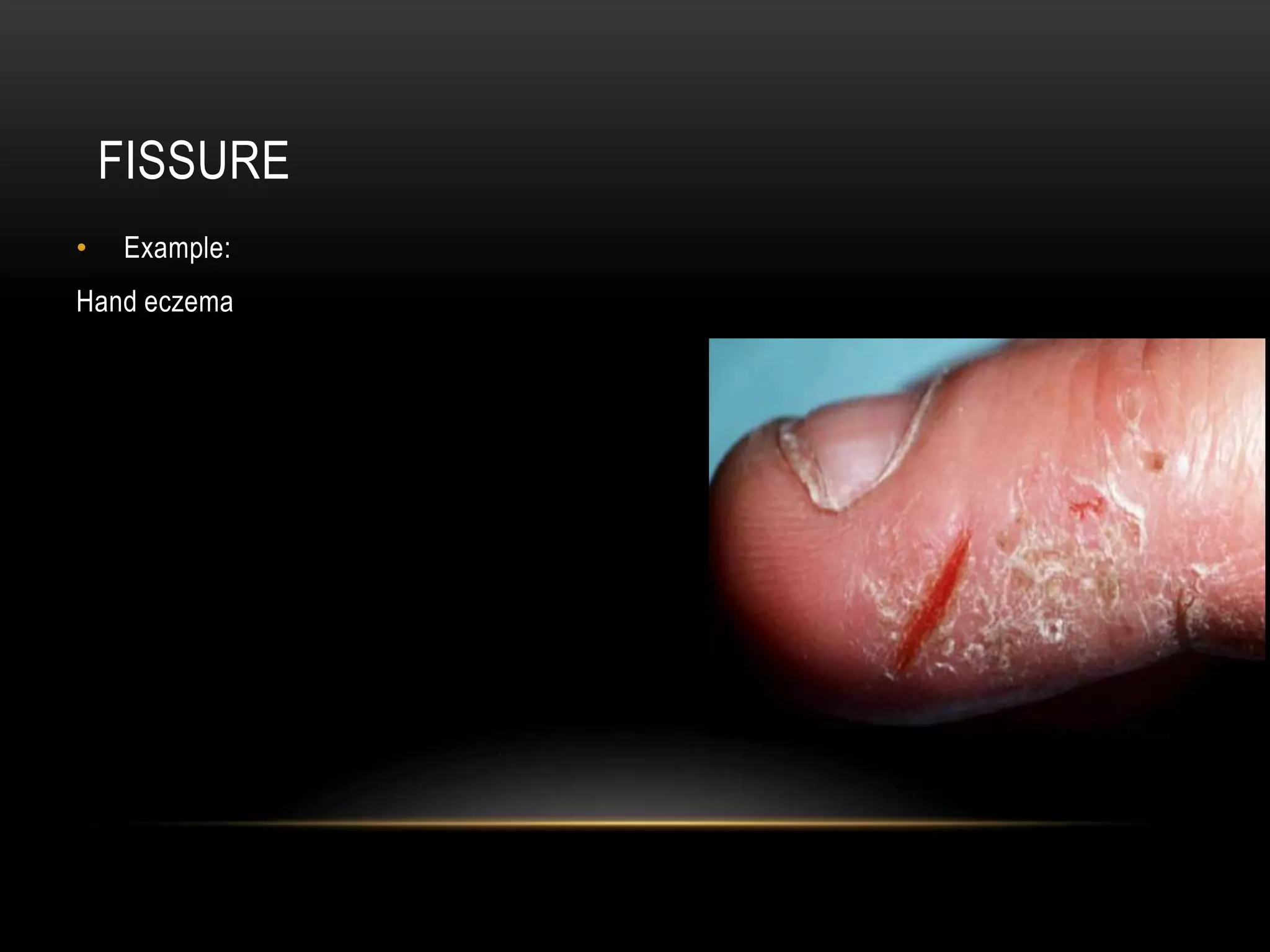 Skin lesions morphology.pptx