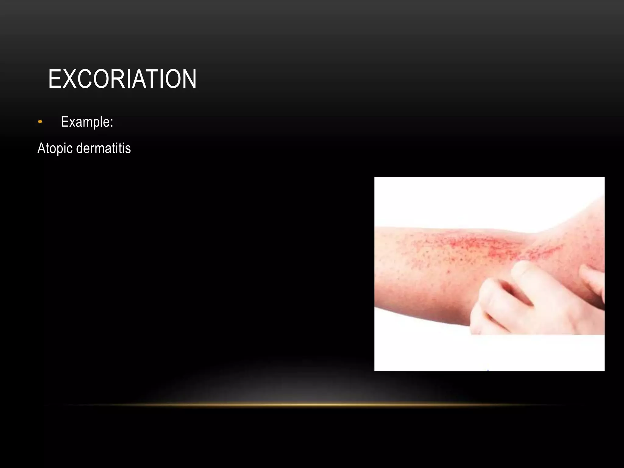 Skin lesions morphology.pptx