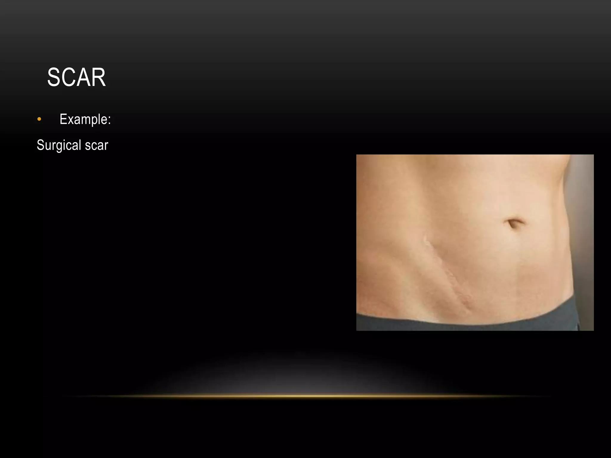 Skin lesions morphology.pptx