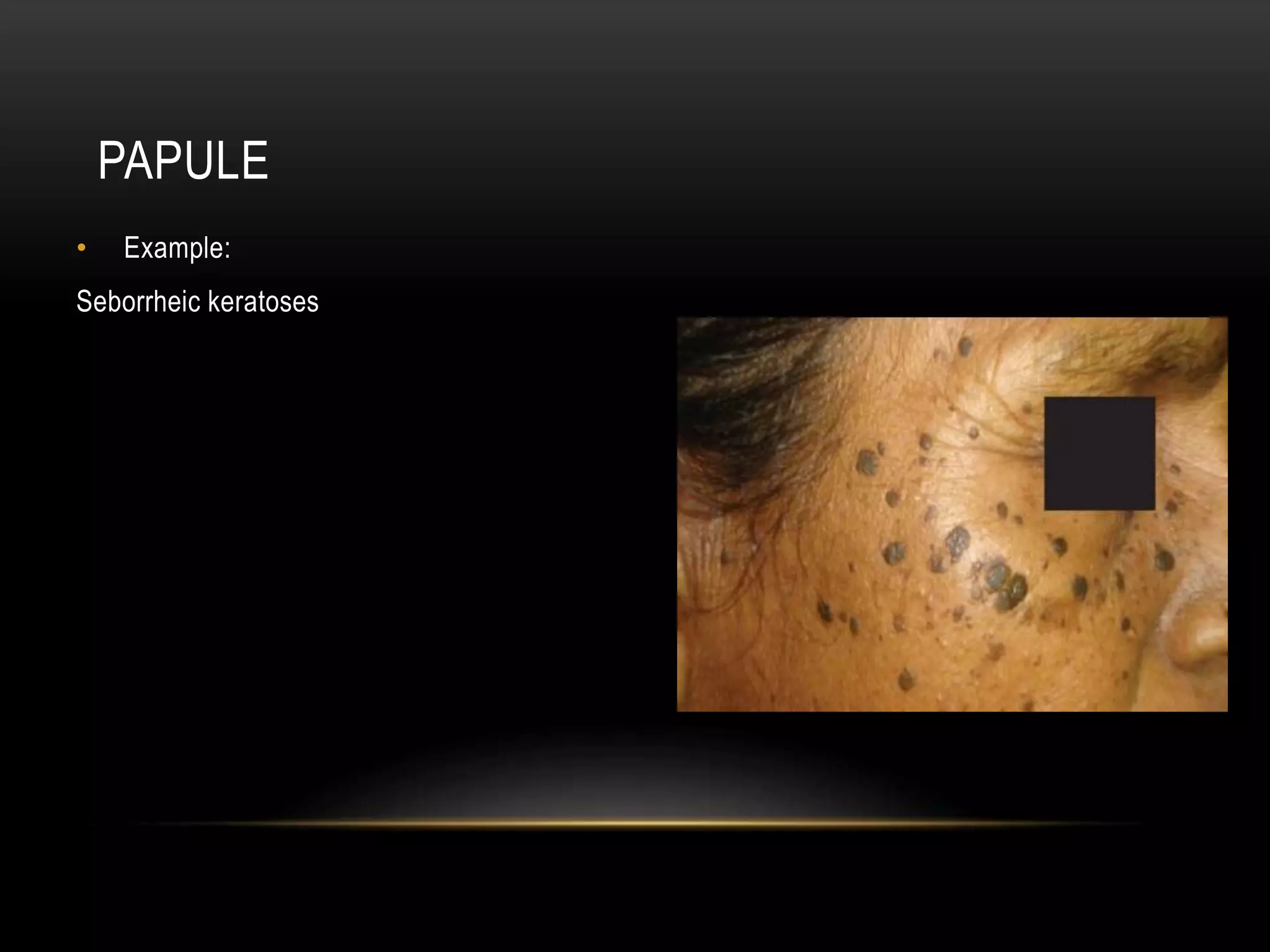Skin lesions morphology.pptx
