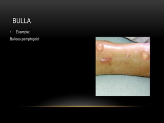 Skin lesions morphology.pptx