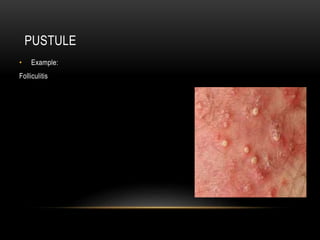 Skin lesions morphology.pptx