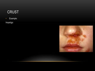 Skin lesions morphology.pptx