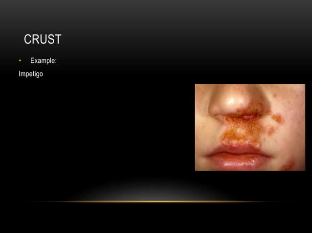 Skin lesions morphology.pptx