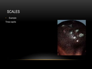 Skin lesions morphology.pptx