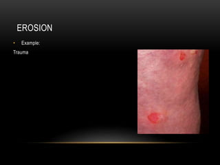 Skin lesions morphology.pptx