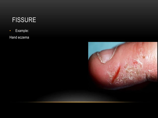 Skin lesions morphology.pptx