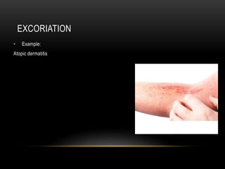 Skin lesions morphology.pptx