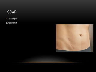 Skin lesions morphology.pptx