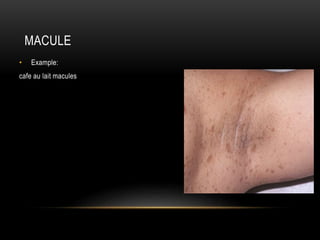 Skin lesions morphology.pptx