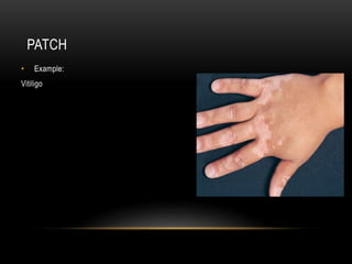 Skin lesions morphology.pptx