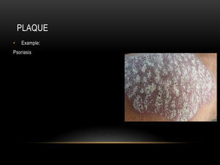 Skin lesions morphology.pptx