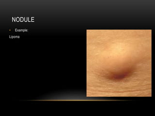 Skin lesions morphology.pptx