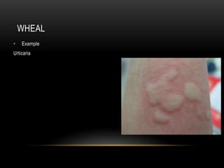 Skin lesions morphology.pptx